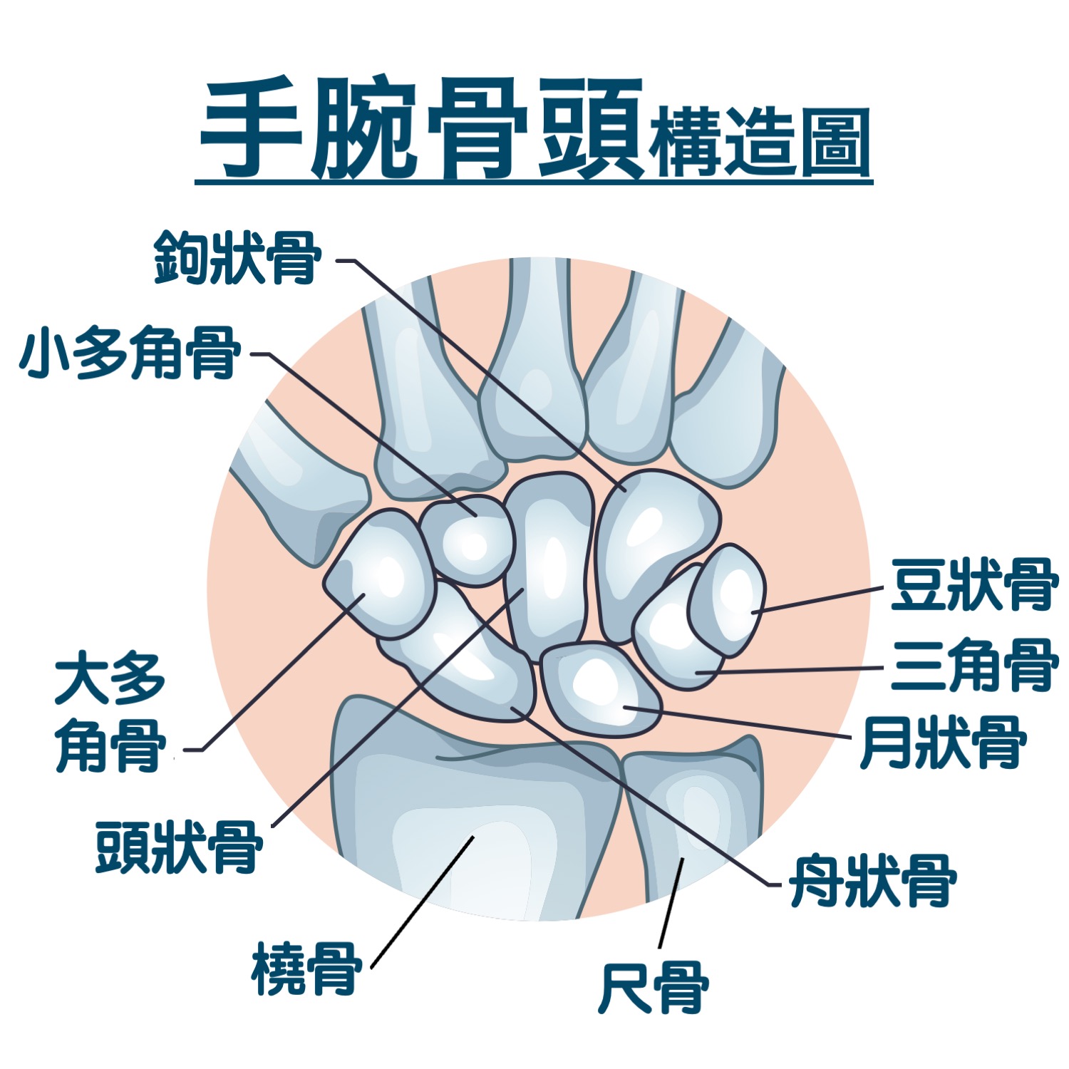 鉤狀骨骨折｜手腕疾病專欄｜骨科 手外科專業醫師團隊